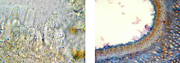 Micología. Microscopía de las Setas. El Himenio en los Basidiomicetos