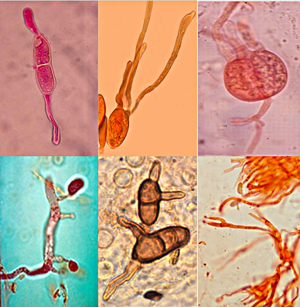Micología. Microscopía de las Setas. El Himenio en los Basidiomicetos